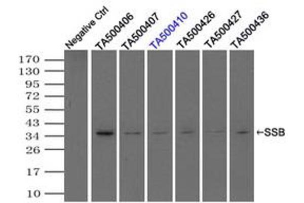 SSB Anticorps
