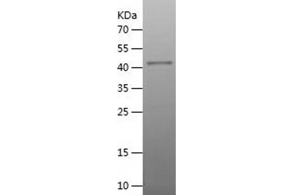 LAMP2 Proteins